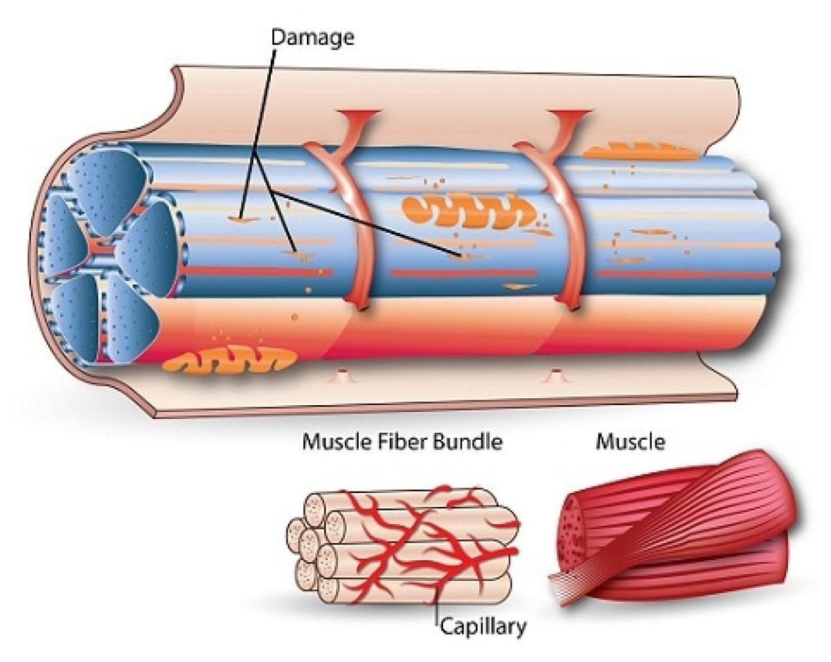 Delayed Onset Muscle Soreness Diagram Training Load And Current